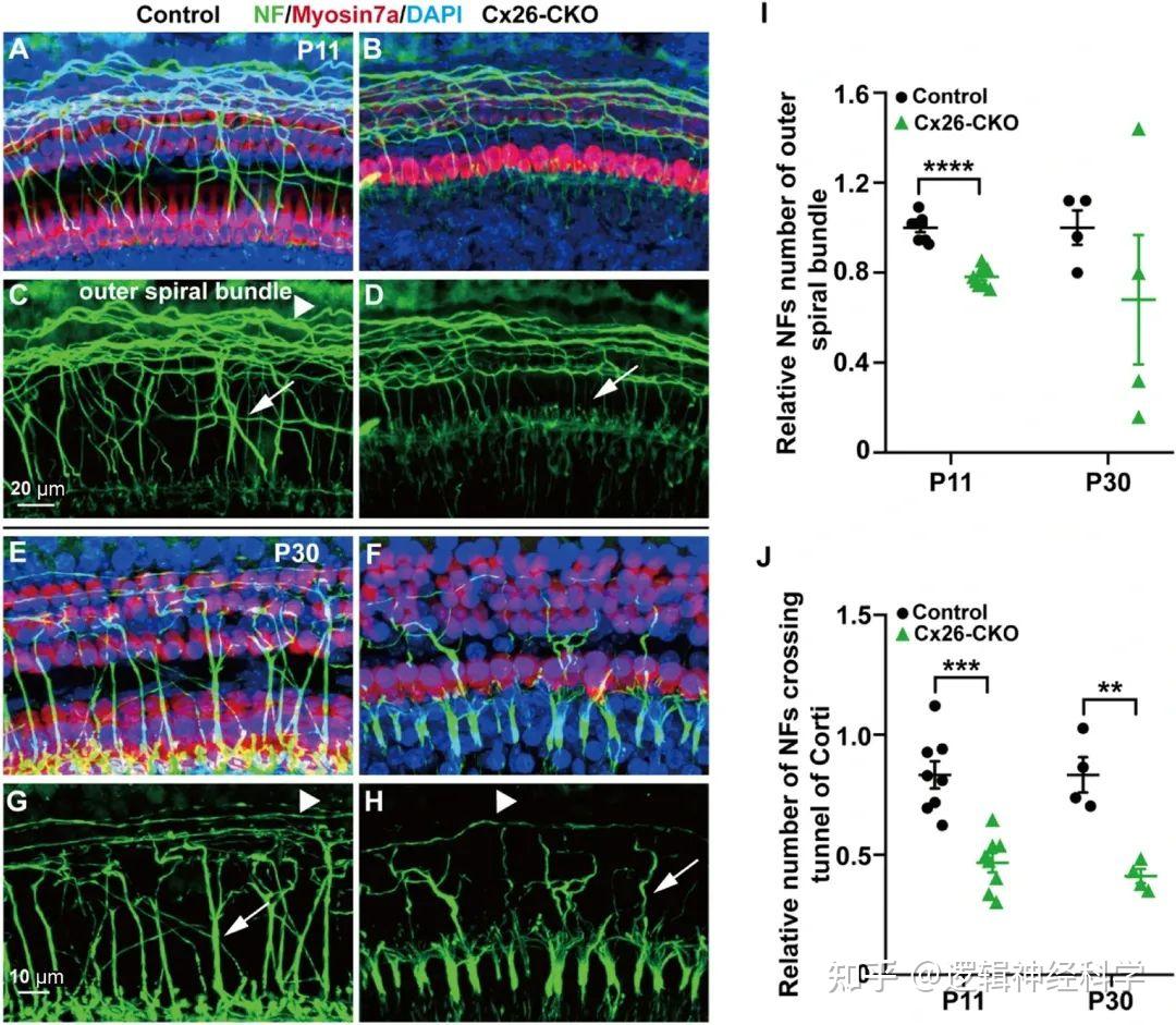 Neurosci Bull︱华中科技大学孙宇团队建立新的Cx26条件敲除小鼠模型，揭示Gjb2敲除小鼠外周听觉系统的病理生理改变 - 知乎