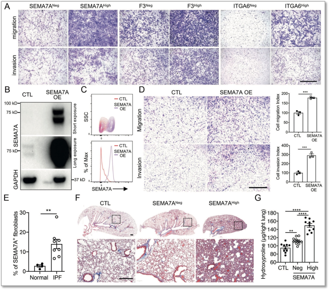 J Exp Med︱蒋典华团队揭示HER2是调控肺成纤维细胞侵袭和肺纤维化新靶点 - 知乎