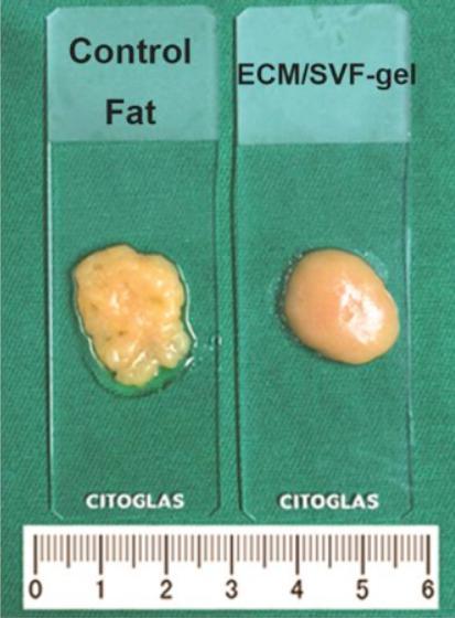 ECM/SVF-GEL：自体脂肪移植进入再生修复的2.0时代 - 知乎