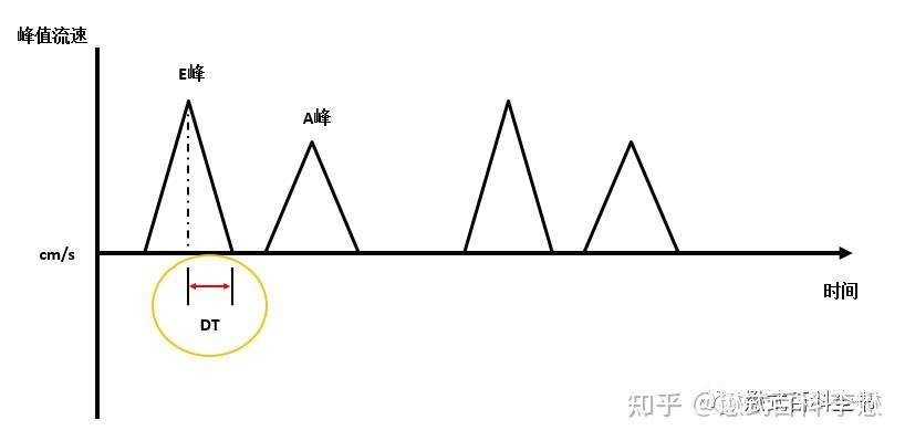 什么叫E/A ratio E/A比值 - 知乎