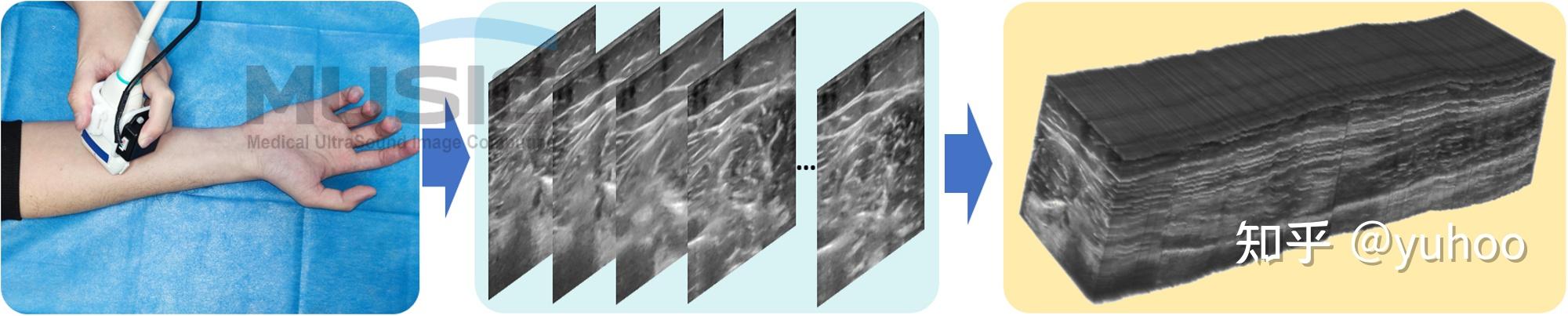 MICCAI 2022 | 深圳大学医学部智能超声实验室6篇论文分享！ - 知乎