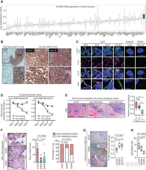 IF=38.272|Cancer Discov.| IL1RAP——尤文氏肉瘤的新表面靶标 - 知乎