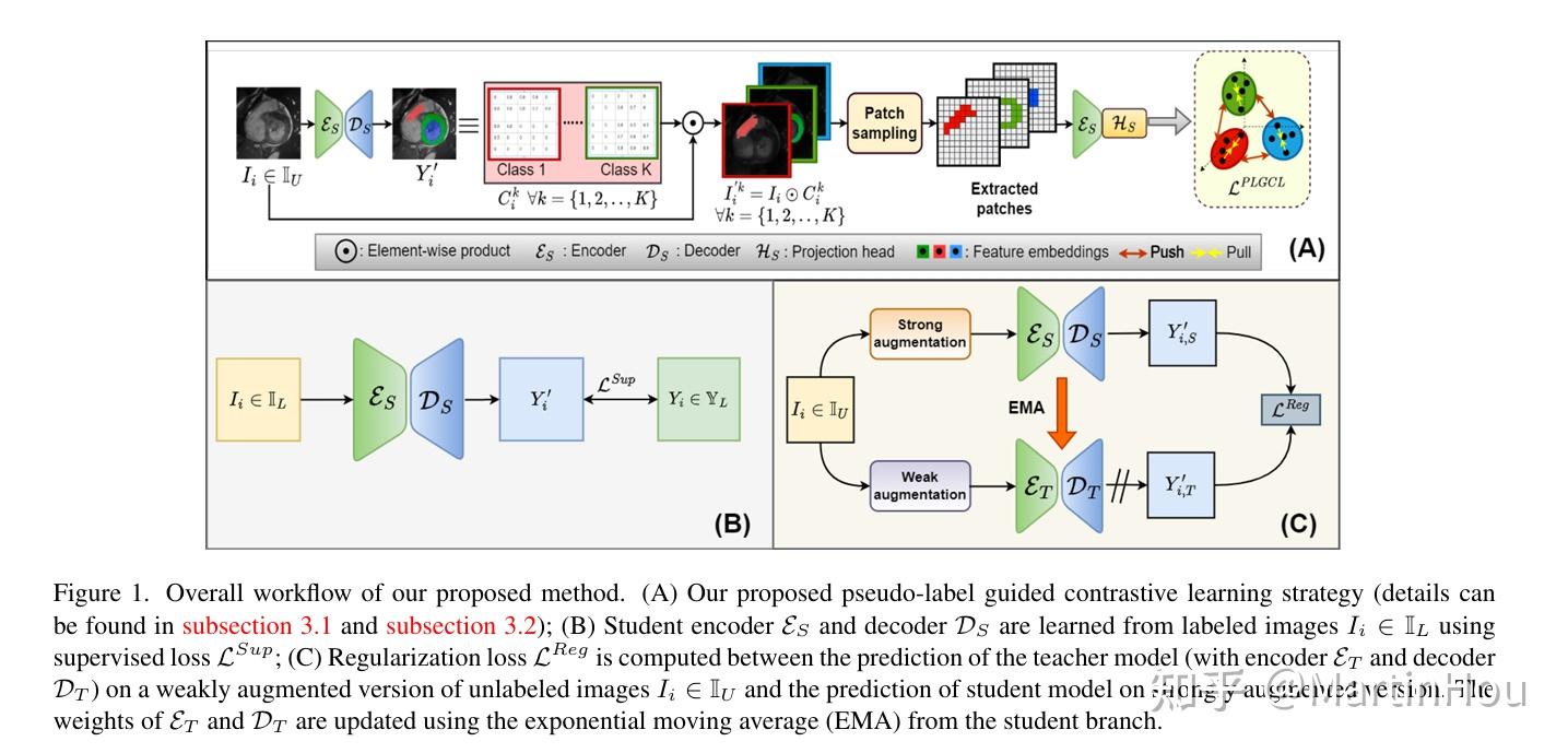 论文笔记 - Pseudo-label Guided Contrastive Learning for Semi-supervised ...