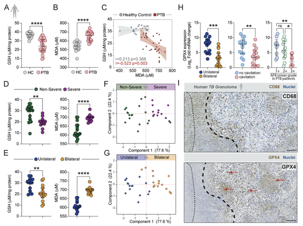 免疫学顶刊JEM丨GPX4-结核病-细胞死亡丨从临床到基础 - 知乎