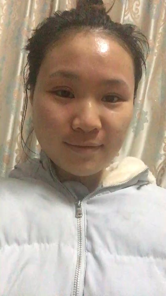 痘痘啊 知乎