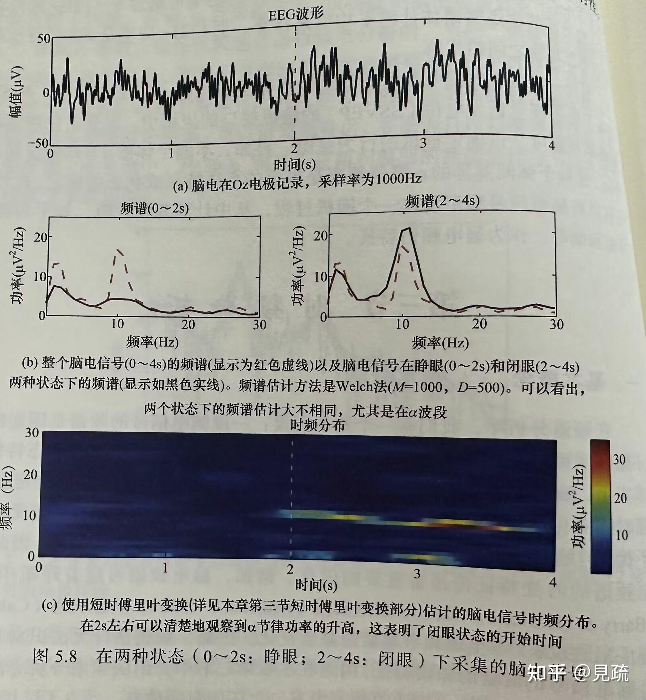 脑电信号处理与特征提取 读书笔记 5 知乎