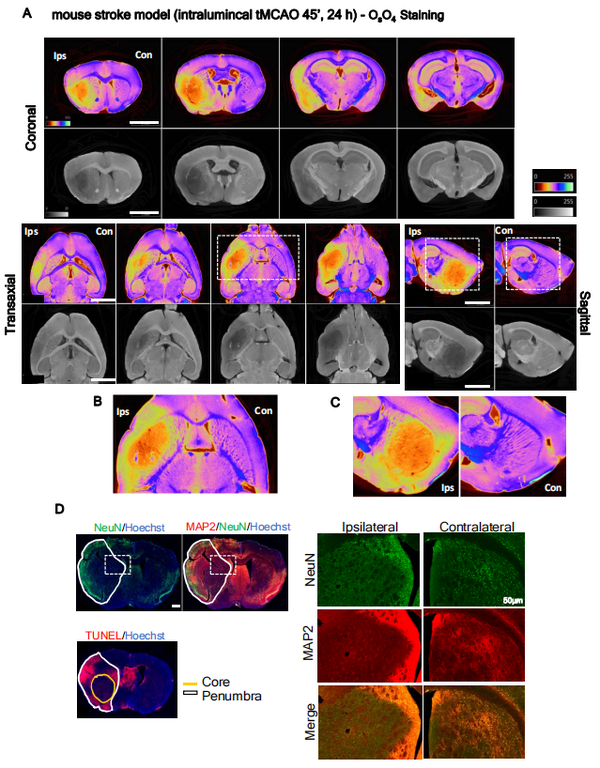 文献解读：小鼠中风模型 高分辨率micro-CT成像:从梗死表征到自动区域分割 - 知乎