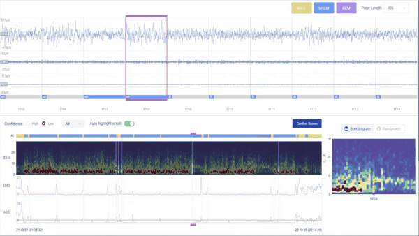 【脑科学】动物睡眠病状中的REM Sleep - 知乎