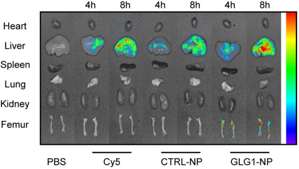 Cell Rep Med｜苏佳灿/徐灿/陈晓团队合作揭秘炎症性肠病骨丢失机制 - 知乎