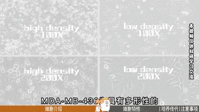 MDA-MB-436细胞培养，人乳腺癌细胞培养攻略 - 丰晖生物 - 知乎
