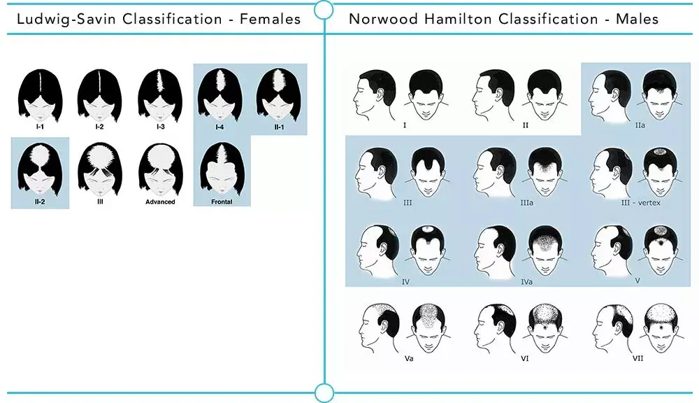 脱发和正常掉发的区别是什么？ - 知乎