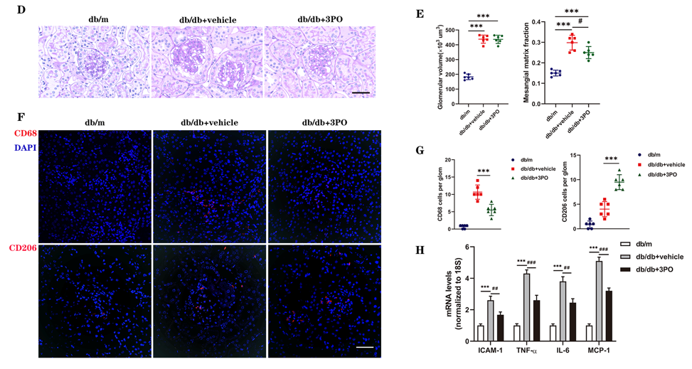 Cell Death Dis︱洪权教授课题组揭示IGFBP5在糖尿病肾脏病进展中的作用机制 - 知乎