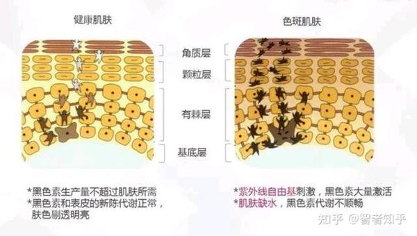 护肤品是如何美白肌肤的？ 知乎