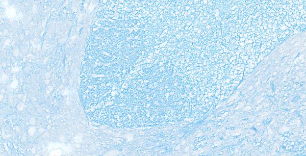 LFB髓鞘染色（步骤及流程） - 知乎