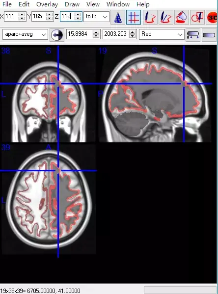 freesurfer学习：ROI Volume to Surface空间变换提取数据 - 知乎