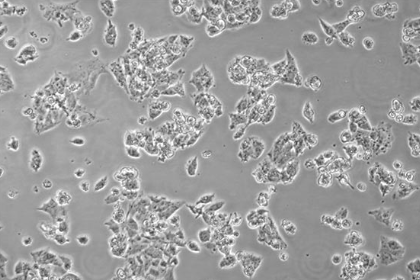HepG2、SK-Hep-1:苏州鉴达细胞鉴定(Cell Line Authentication)预警系列14 - 知乎