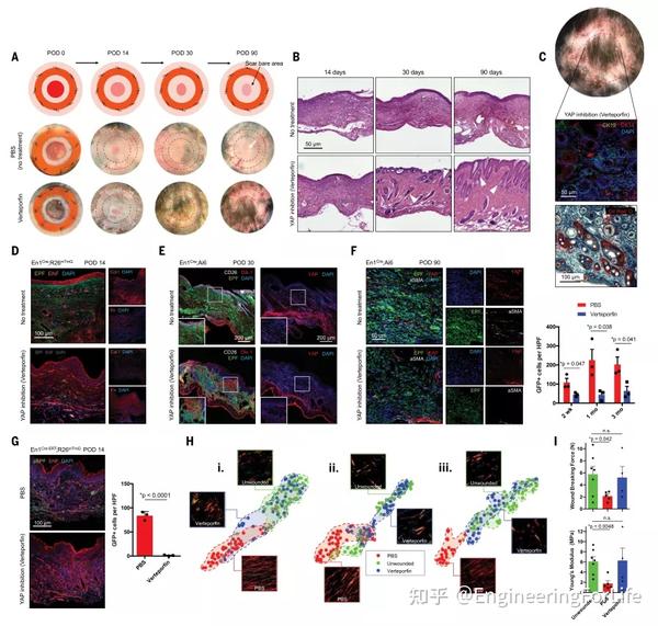 Science:抑制成纤维细胞Engrailed-1表达实现无痕化愈合 - 知乎