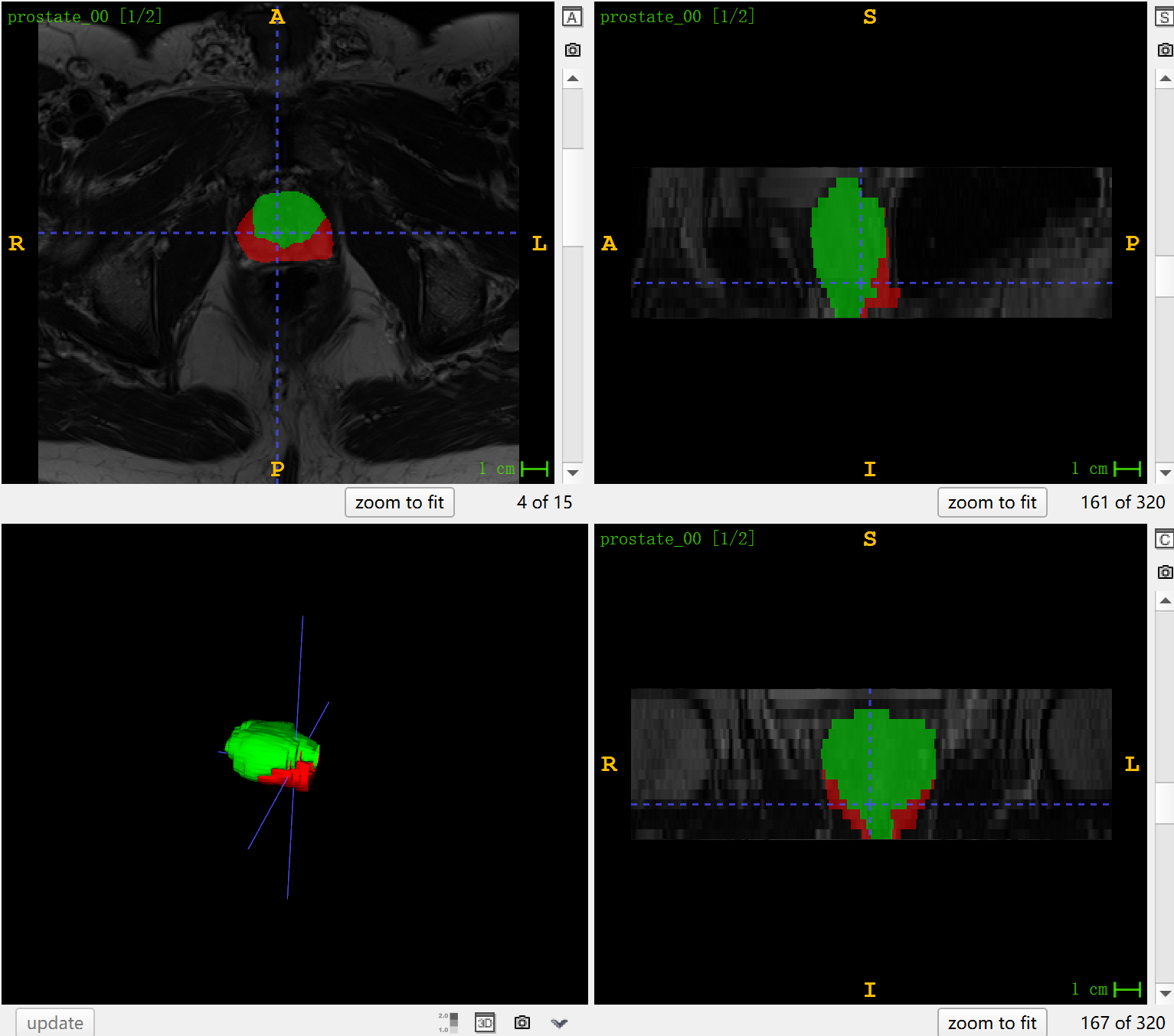 MSD Prostate 数据集介绍 - 知乎