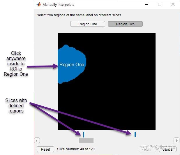 MATLAB图像处理：92：使用 Volume Segmenter 处理块图像