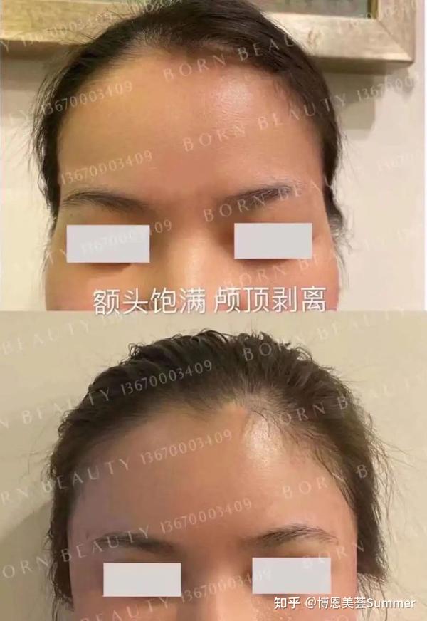 菱形脸、梨形脸、长形脸，3种问题脸型调整什么能转 劣势”变特色？ 知乎
