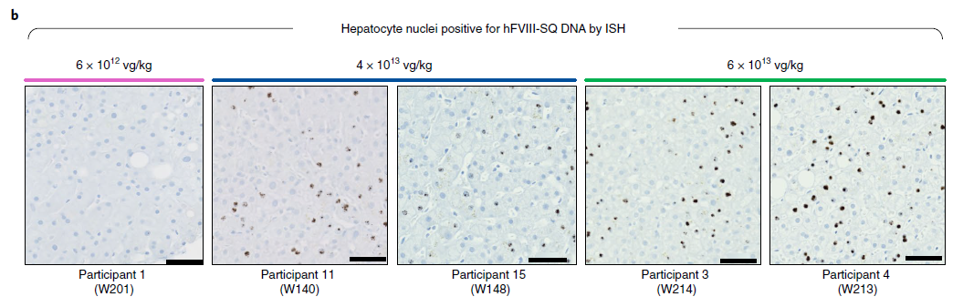 RNAscope 在基因治疗AAV载体相关检测中的应用（下） - 知乎
