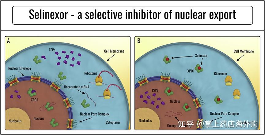 塞利尼索（希维奥、Xpovio）治疗多发性骨髓瘤和急性白血病，已纳入医保报销，附说明书！ - 知乎