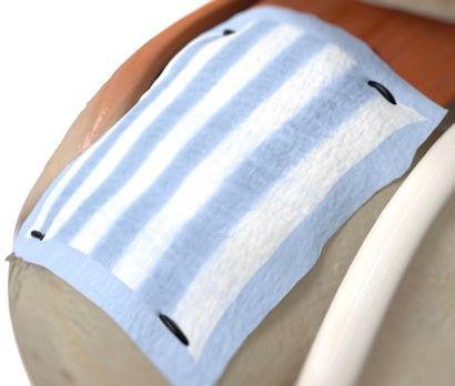 又一医疗器械获批！致力于肩袖损伤修复 - 知乎