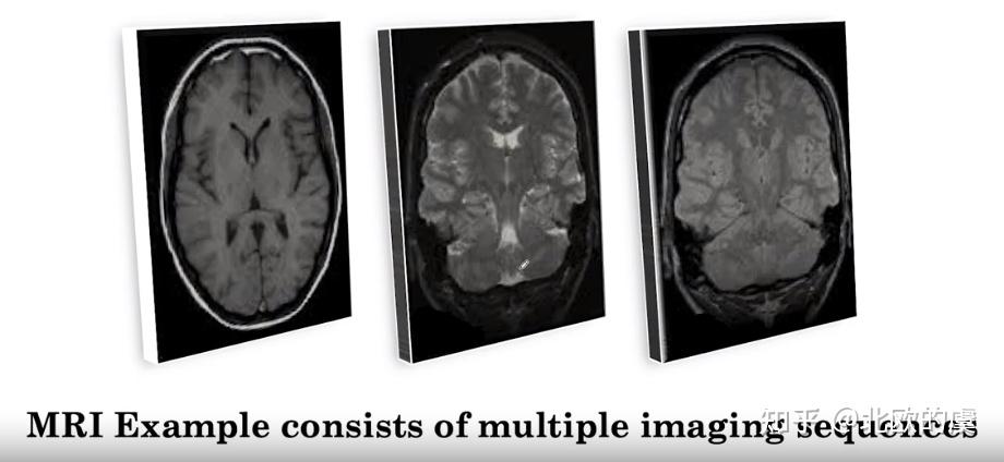 医学影像深度学习系列（六）- 了解MRI（上）-多通道3D图像 - 知乎