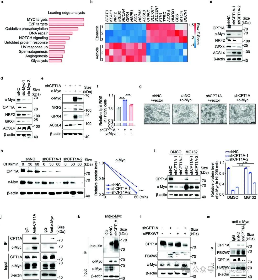 STTT | 靶向CPT1A可诱导铁死亡并与肺癌免疫治疗产生协同作用 - 知乎