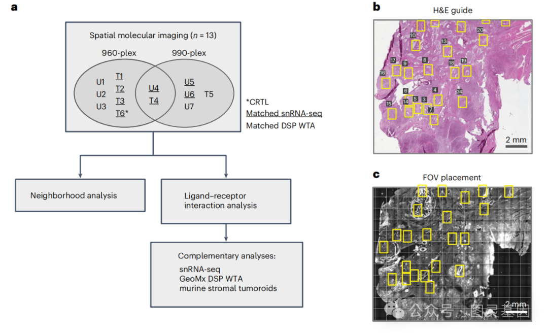 Nat Gen ｜ 哈佛医学院突破：空间转录组学揭示胰腺癌微环境治疗抵抗新机制 - 知乎