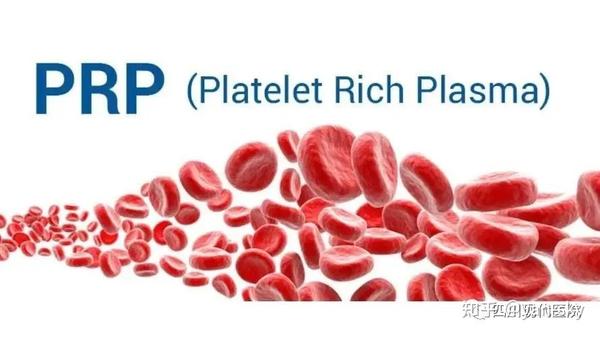 什么是PRP？PRP治疗有什么优势？ - 知乎