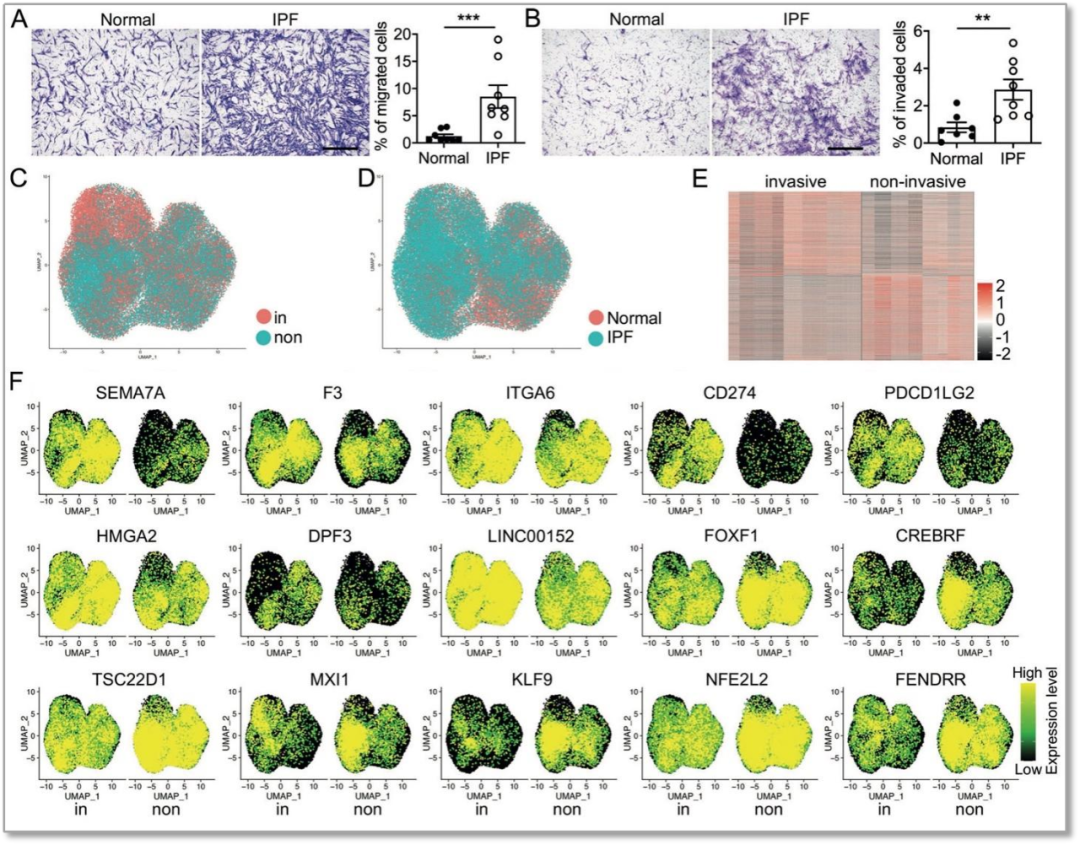 J Exp Med︱蒋典华团队揭示HER2是调控肺成纤维细胞侵袭和肺纤维化新靶点 - 知乎