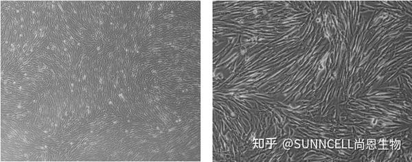 细胞攻略 | MRC-5(人胚肺细胞)细胞培养教程 - 知乎