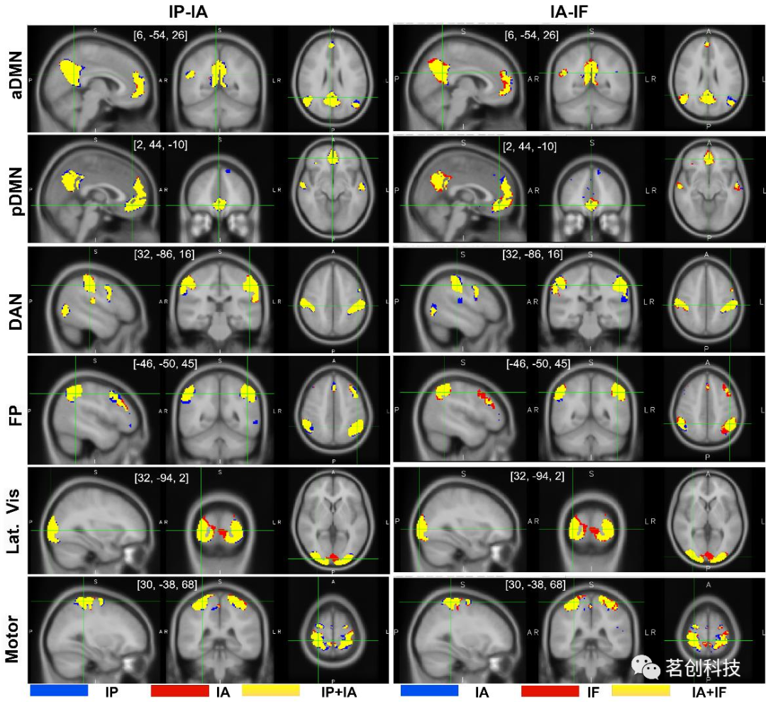 fMRI时间序列振幅和相位对功能连接分析的影响 - 知乎