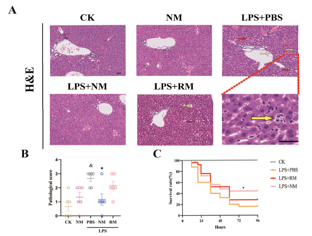 Materials Today Bio丨新型纳米诱饵在脓毒症中的抗炎作用 - 知乎