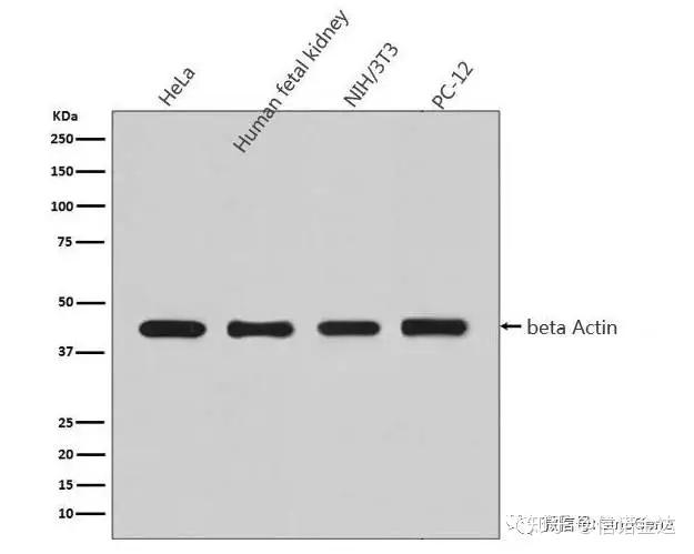 Western Blot 中如何选择内参抗体？ - 知乎