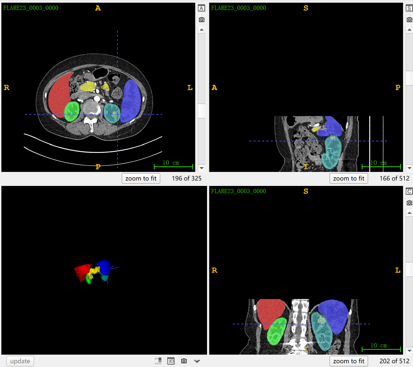 FLARE 2023 数据集介绍 - 知乎