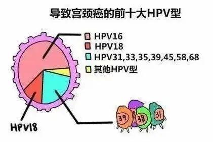 【病例分享】感染HPV16、39保守治疗，时隔5个月复查CIN2级病变，累及腺体 - 知乎