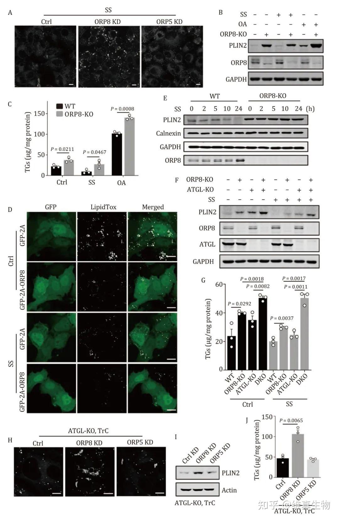 IF=15.328：浙大医学院刘伟/Dante Neculai团队合作揭示脂质转移蛋白ORP8在脂滴自噬中的关键作用 - 知乎