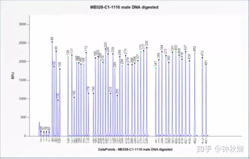 Prader-Willi(PWS)综合征的基因检测 - 知乎