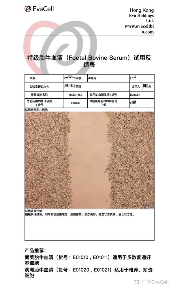 NCM460人正常结肠细胞培养要点 - 知乎