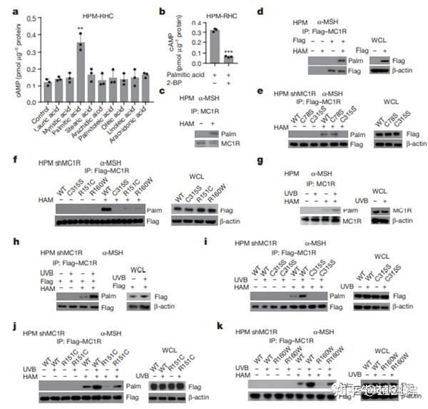 波士顿大学医学院崔儒涛团队揭示MC1R的棕榈酰化依赖性活化可防止黑色素瘤生成的作用机制 - 知乎