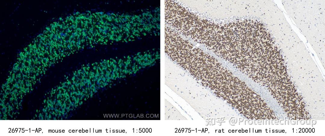 神经细胞标志物汇总！ - 知乎
