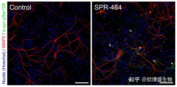 神经衰退疾病研究新工具---α-突触核蛋白寡聚体(SPR-484) - 知乎