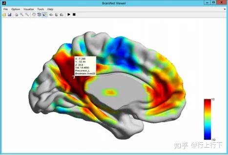BrainNet Viewer:人类大脑连接的网络可视化工具 - 知乎