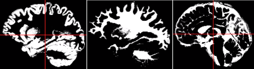 part6 groupica分析fmri - 知乎