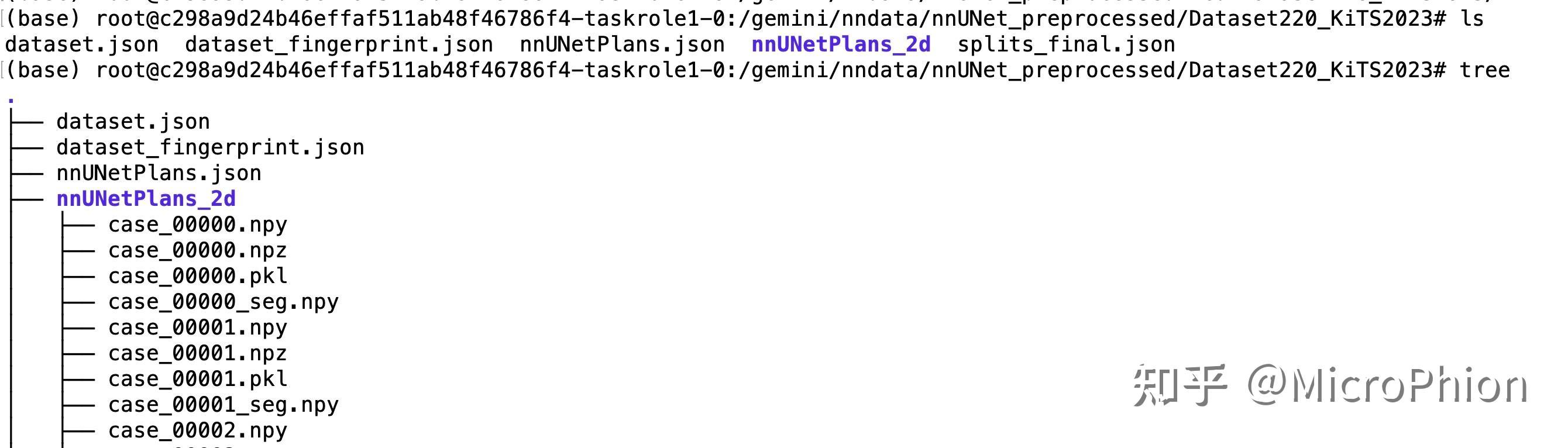 nnU-Net使用系列2: Task09_Spleen - 知乎