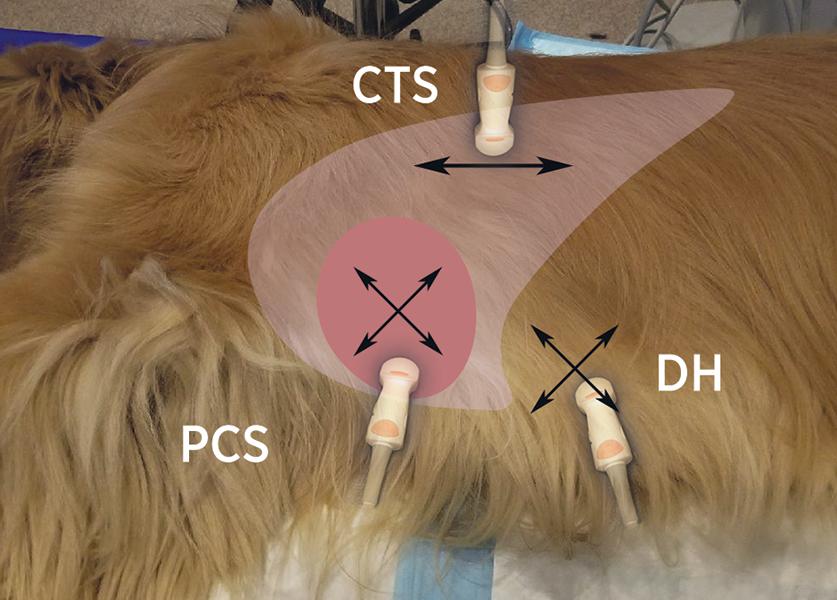 超声评估：AFAST和TFAST概述 - 知乎