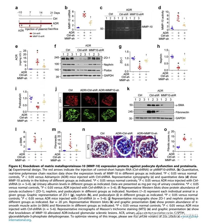 MMP10-新的足细胞损伤介导分子 - 知乎