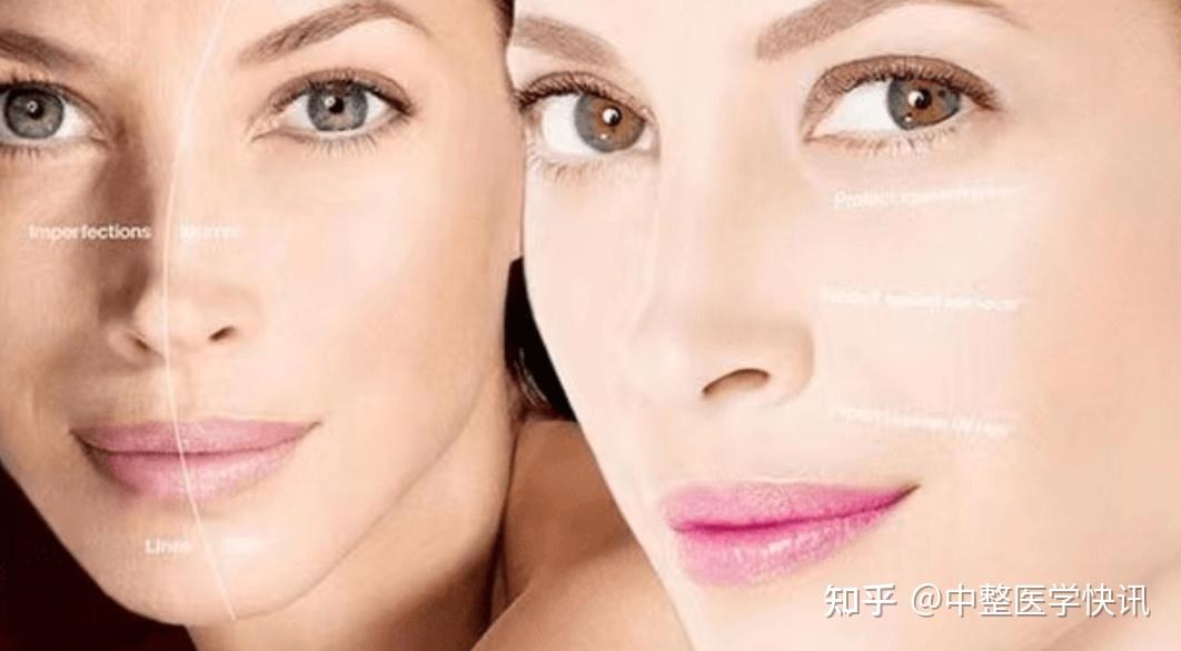 嘘~超声炮一般全脸打多少发、半岛超声炮多少发才有效?打的发数越多越好吗? 知乎